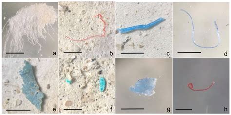 Disentangling Microplastic Pollution On Beach Sand Of Puerto Princesa
