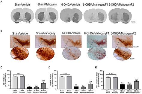 Aqueous Extract Of Swietenia Macrophylla Leaf Exerts An Anti