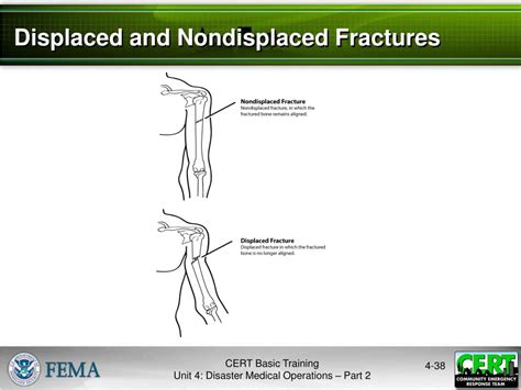 Ppt Disaster Medical Operations — Part 2 Powerpoint Presentation