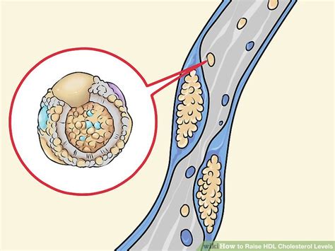 How To Raise HDL Cholesterol Levels Steps With Pictures