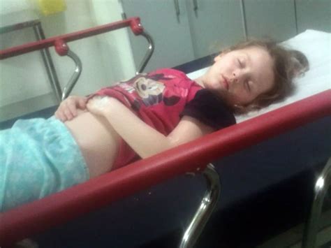 How Does An Appendix Burst