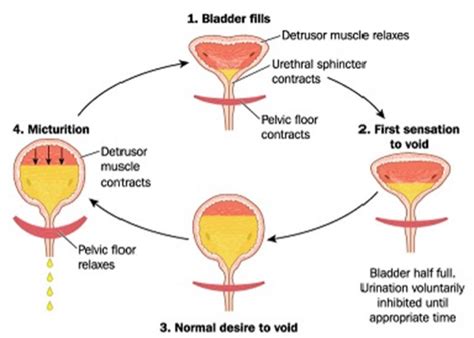 Male Urinary Incontinence Physiopedia
