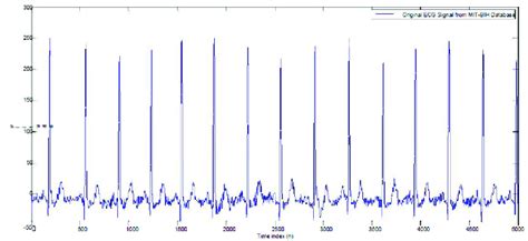 Pure Ecg Signal Taken From Mit Bih Database Download Scientific Diagram