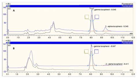 Example Of Chromatogram A The Upper Part Of The Figure Represents Download Scientific