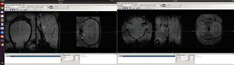 Slicing The Images And Mask In Rbm Rodent Brain Mask Segmentation And