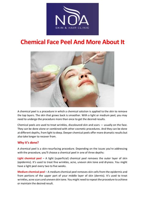 Ppt Chemical Face Peel And More About It Powerpoint Presentation