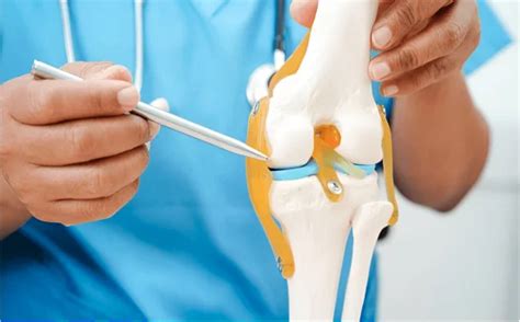 What Is Patellar Realignment Surgery Key Insights