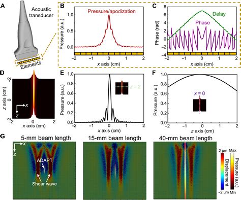Acoustic Diffractionresistant Adaptive Profile Technology Adapt For Elasticity Imaging