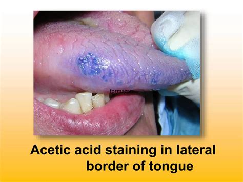 Vital Staining Ppt Notes Pptx