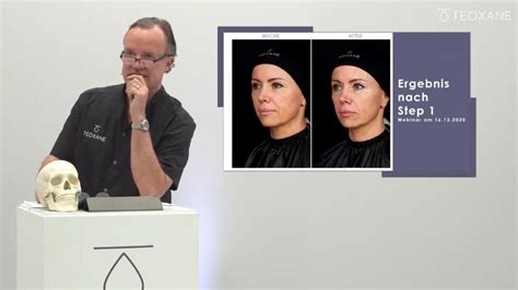 Drstefan Lipp On Linkedin We Are Proud To Offer You From Today On Officialy Live Onsite