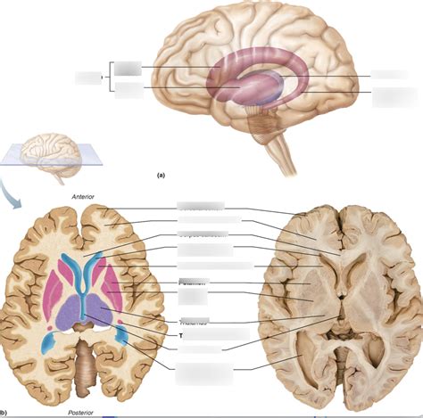 1210 Lab Exam Diagram Quizlet