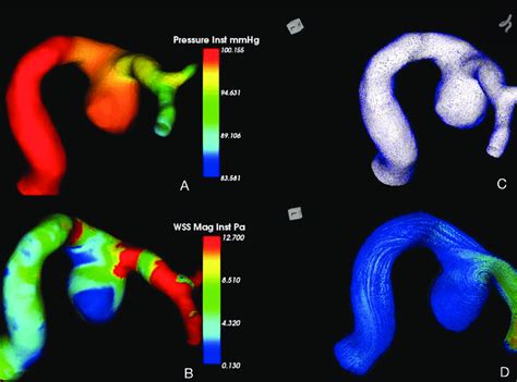 Computational Fluid Dynamics Cfd Using The Amin Corporation Zio
