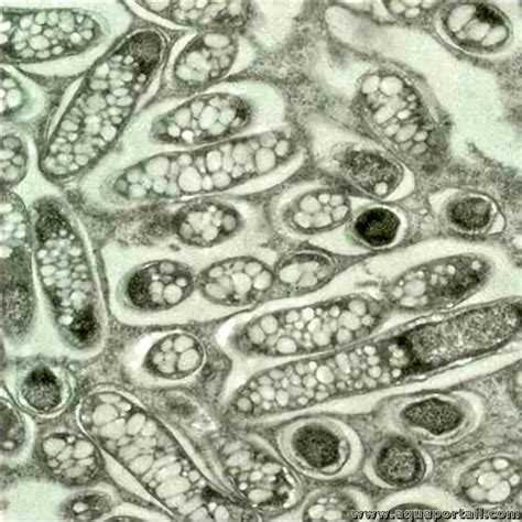 Bacteroides Fragilis Définition Et Explications
