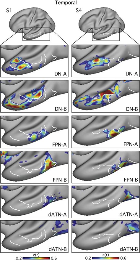 Detailed Anatomy Of Six Distinct Networks Lateral Temporal Cortex In A