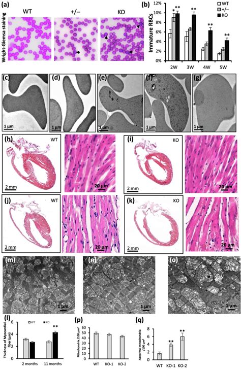 Miro2 Deficiency Delays Reticulocyte Maturation In The Peripheral Blood