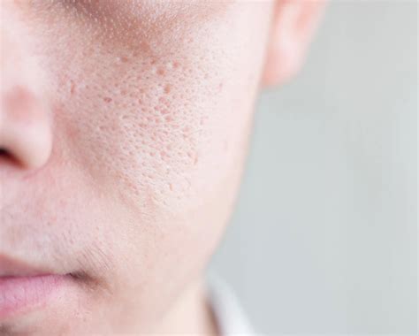 Skin Concerns Healthone Skin Clinic