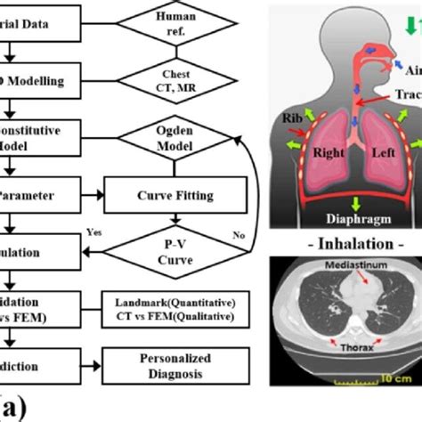 A Computational Framework Patient Specific Modeling Procedure Of Download Scientific Diagram