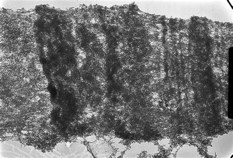 Drosophila Melanogaster Polytene Chromosome Cil25395 Doccheck