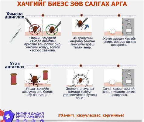 Хачиг дайжуулагч үргээгч бүтээгдэхүүн хэрэглэхийг зөвлөж байна Jim Mn