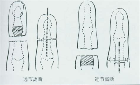 医护教育 手术图库
