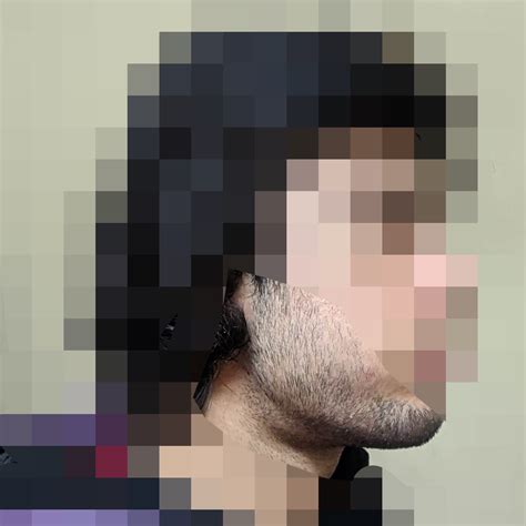 23m What Should I Do To Have A Defined Jaw I Feel That I Have Some Kind Of Lump There R