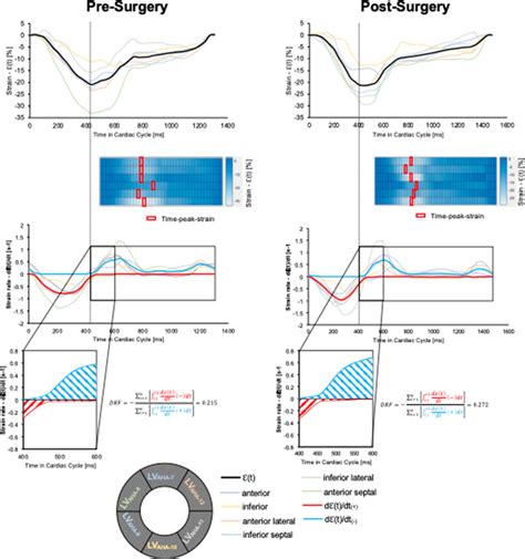 Ventricular Functional And Segmental Assessment For A Reference Patient Download Scientific