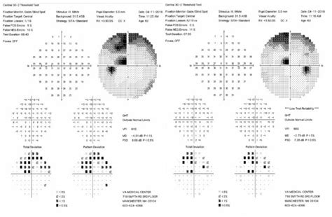 Differentiating Intracranial Pathology Using Visual Fields A Teaching