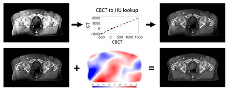 synthetic ct generation in raystation ipem
