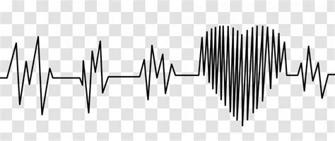 Electrocardiography Heart Rate Acute Myocardial Infarction Clip Art