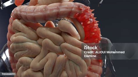인간의 소화 시스템의 해부학 장의 개념 게실염 3d 렌더링 게실염에 대한 스톡 사진 및 기타 이미지 게실염 대장염 국소성빈혈 Istock