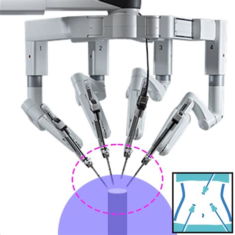 Da Vinci Sp Robotic Surgery For Uterus Preservation At A Hospital In Busan South Korea Jivaka