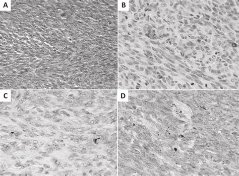 The Syt Ssx Fusion Gene Arrow Detected In Frozen Sections Employing Download Scientific