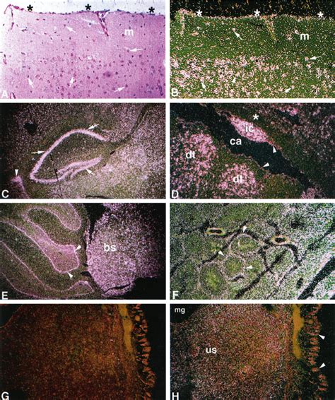 Spatial And Temporal Expression Of The Mouse Gaa Mrna By In Situ Download Scientific Diagram
