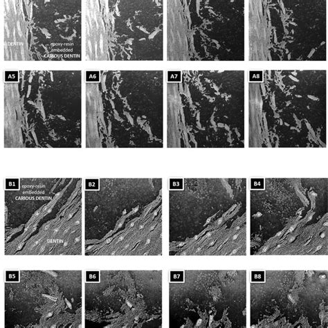 Ab Sem Photomicrographs Of Two Fib Sem Section Series Of 30 Nm Thick
