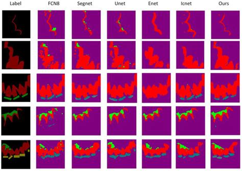 Dental Lesion Segmentation Using An Improved Icnet Network With Attention