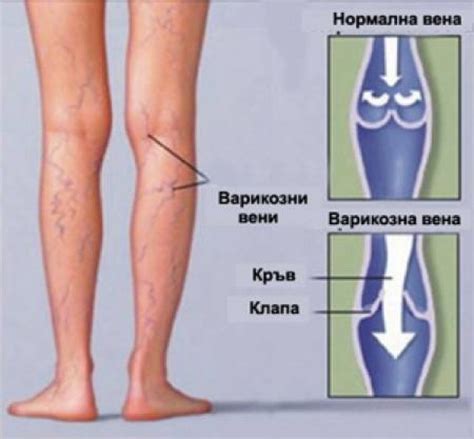 Безплатни прегледи за съдови заболявания в „Софиямед“ Болница Софиямед