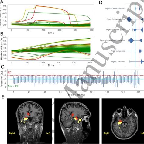 Bayesian Estimation For Empirical Seeg Data Of A Selected Patient A Download Scientific