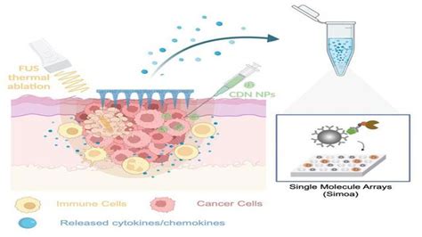 Microneedle Platform Enables Minimally Invasive Monitoring Of Skin Cancer Immunotherapy