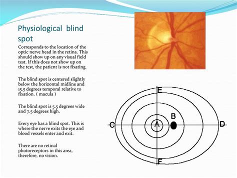 Eye Diagram Blind Spot At Dale Armour Blog