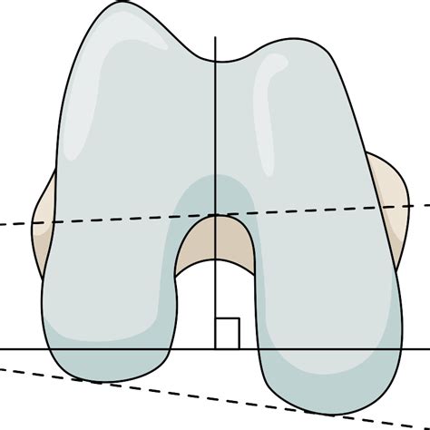 Measured Resection Knee Figure Science Figures