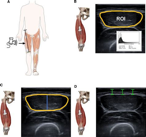 Illustrative Representation Of Ultrasound Parameters Of The Rectus Download Scientific Diagram