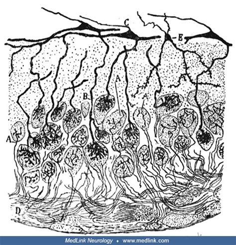 Disorders Of Olfaction Medlink Neurology