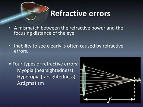 Consultant Ophthalmologist Ophthalmology Department Ppt Download