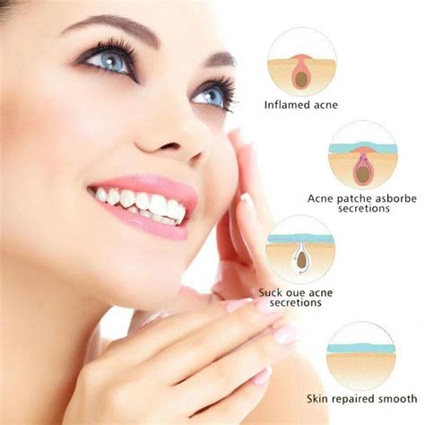 Ly36pcspatch Acne Patch Salicylic Pimple Patch Blemish Treatment Skin