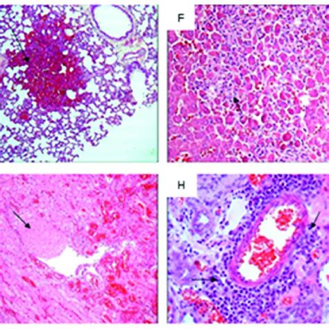 Schematic Of The Type II Secretion System T S Loci In Different Download Scientific Diagram