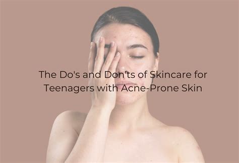 Acne Prone Skin Essential Dos And Donts For Clear Healthy Skin In