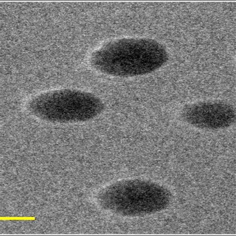 Transmission Electron Microscope Image Of Nano Selenium Derived From Download Scientific