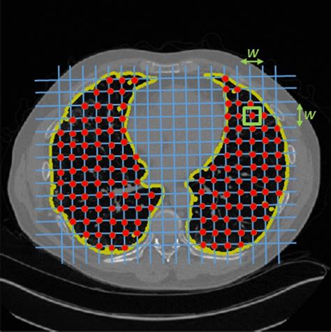 The Schematic Of The Lattice Based Feature Extraction Approach With Download Scientific