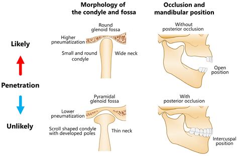 Mandibular Fossa