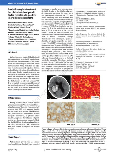Pdf Imatinib Mesylate Treatment For Platelet Derived Growth Factor